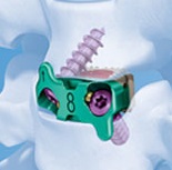 ZERO-P™ VA Stand Alone Spacer - SPINEMarketGroup