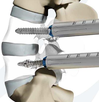Alphatec Spine Logo